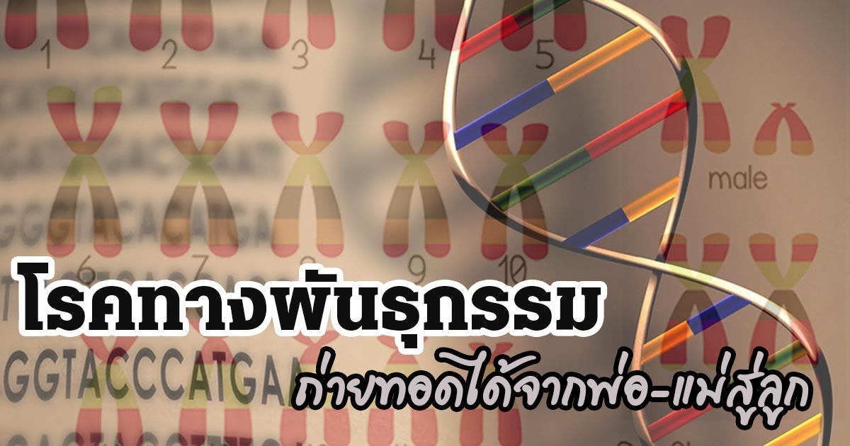 ความคิดเห็น โรคทางพันธุกรรม ถ่ายทอดได้จากพ่อ แม่สู่ลูก
