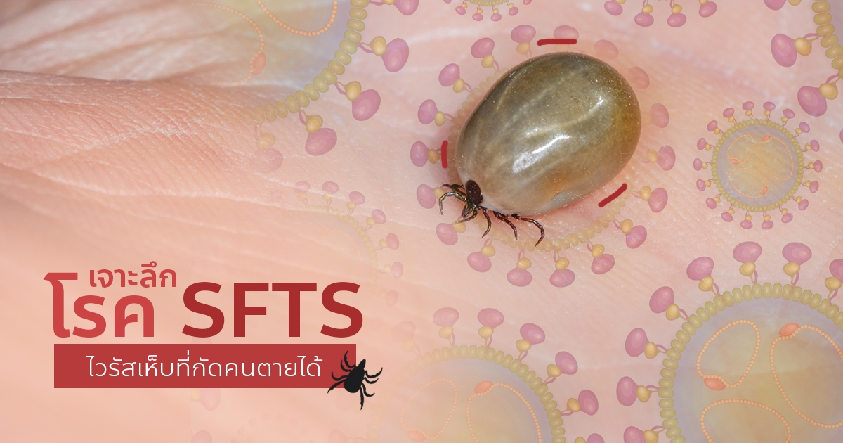 ไวรัสเห็บจีน SFTS ระบาดยังไง เกิดจากอะไร